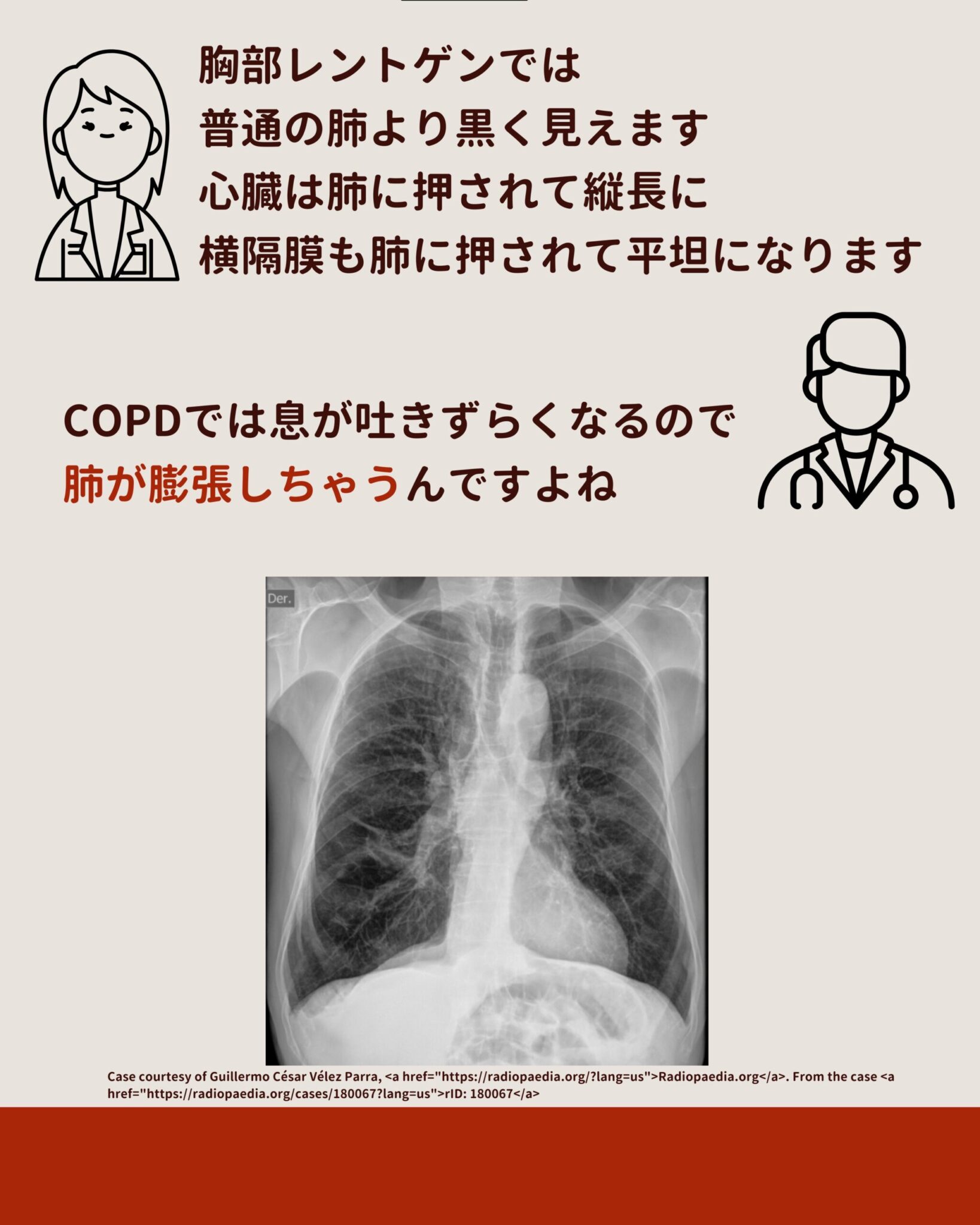 COPDの検査を整理｜スパイロメトリー・CT・FeNOの臨床的意義