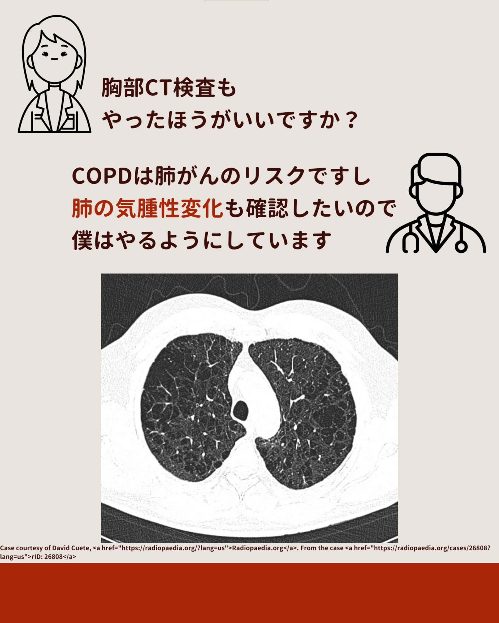 COPDの検査を整理｜スパイロメトリー・CT・FeNOの臨床的意義